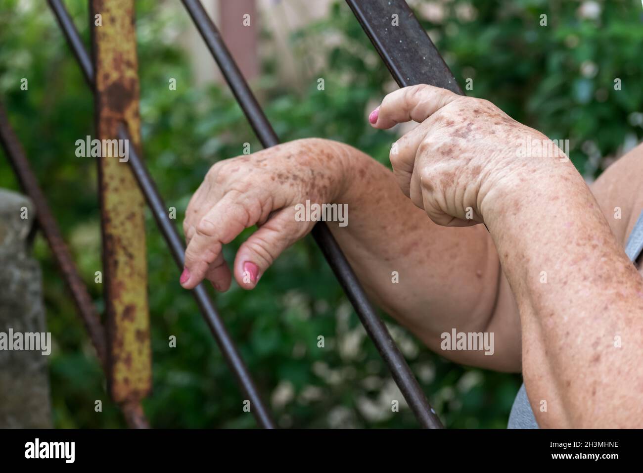 Close up of senior Caucasian female hands with senile spots on her skin ...
