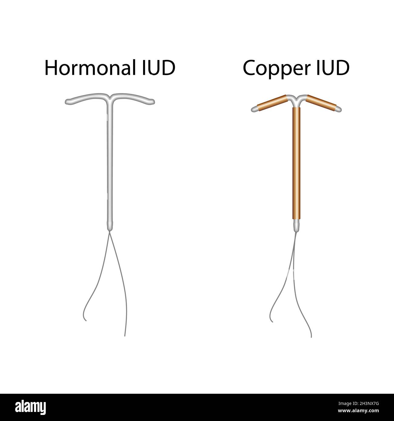 Intrauterine Device