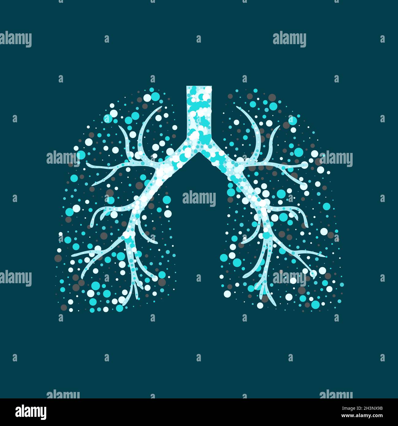 Tuberculosis, conceptual illustration Stock Photo - Alamy