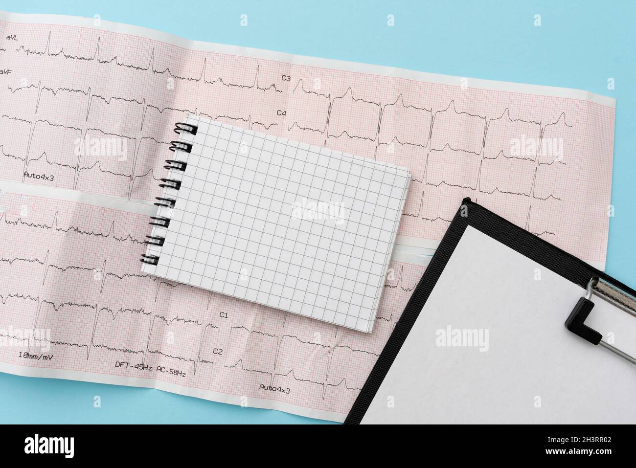 Reading Graph Writing Important Medical Notes Test Result Analysis ...
