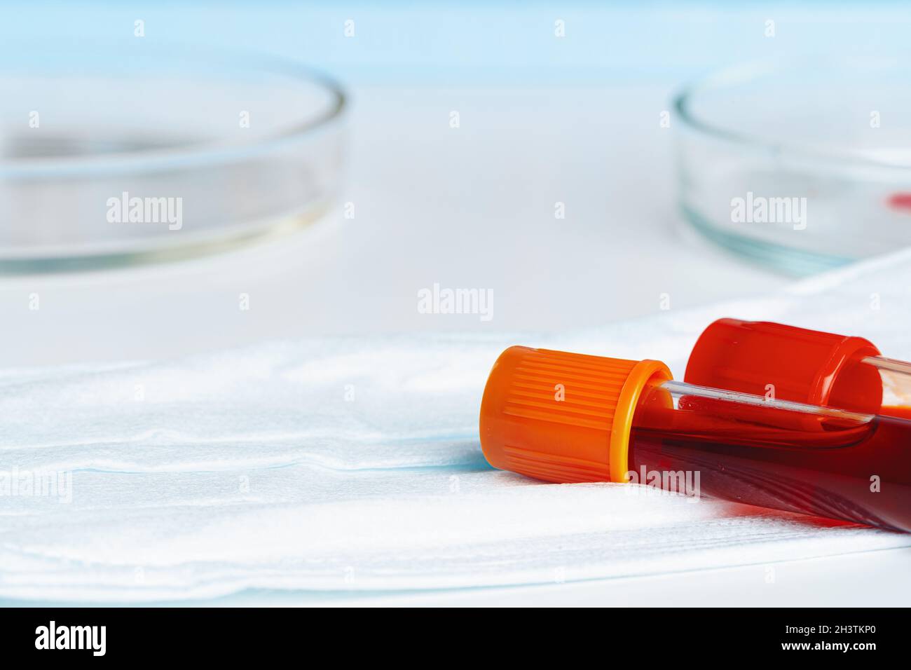 Close up of blood test tube with blood Stock Photo - Alamy