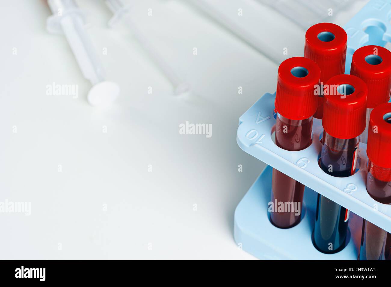 Blood sample tubes medical equipment close up Stock Photo - Alamy