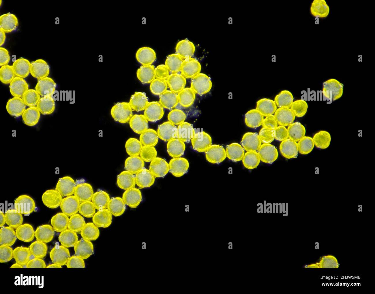 Plant pollen microscopic hi-res stock photography and images - Alamy