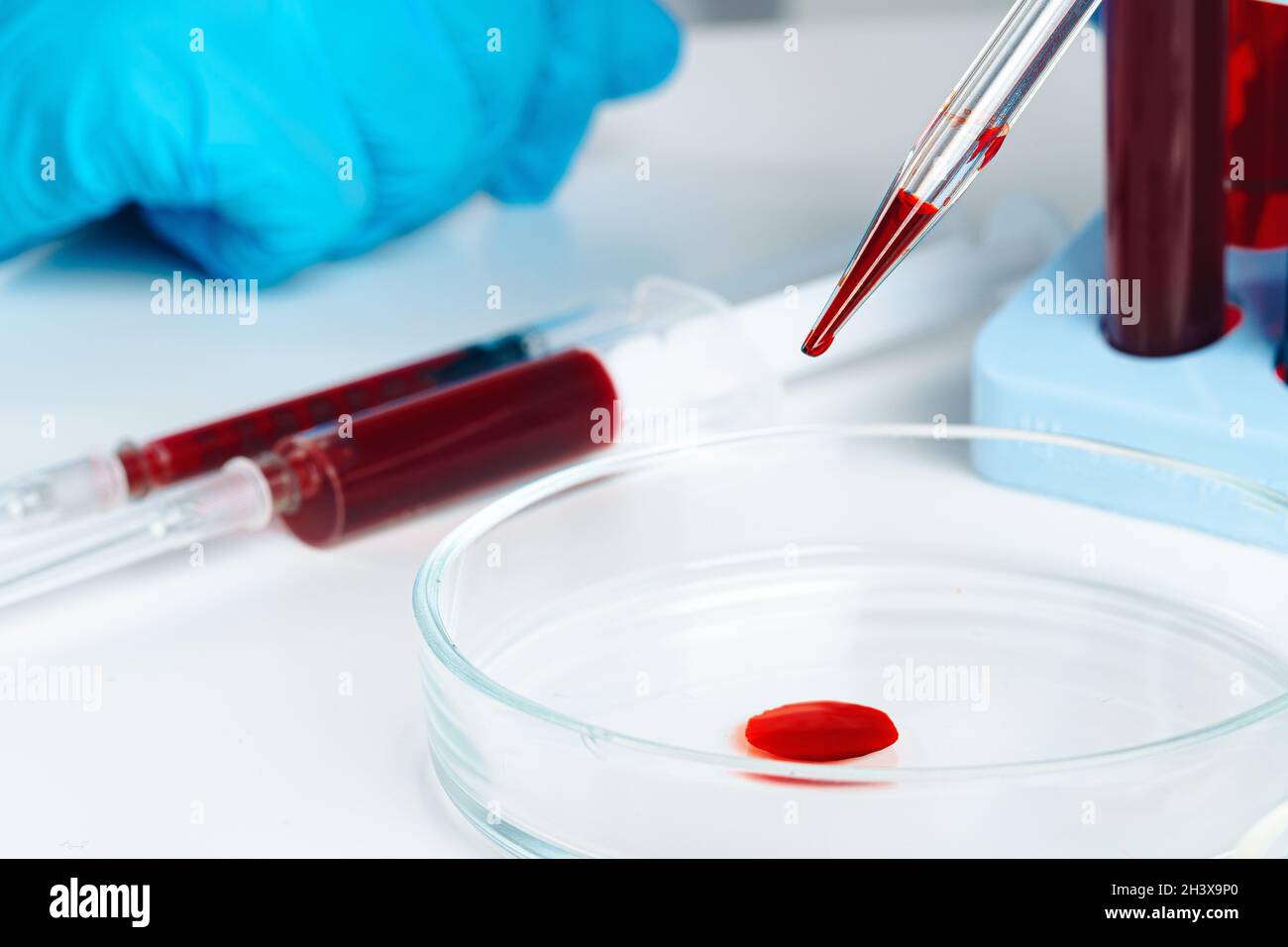 Medical equipment for blood test close up Stock Photo - Alamy