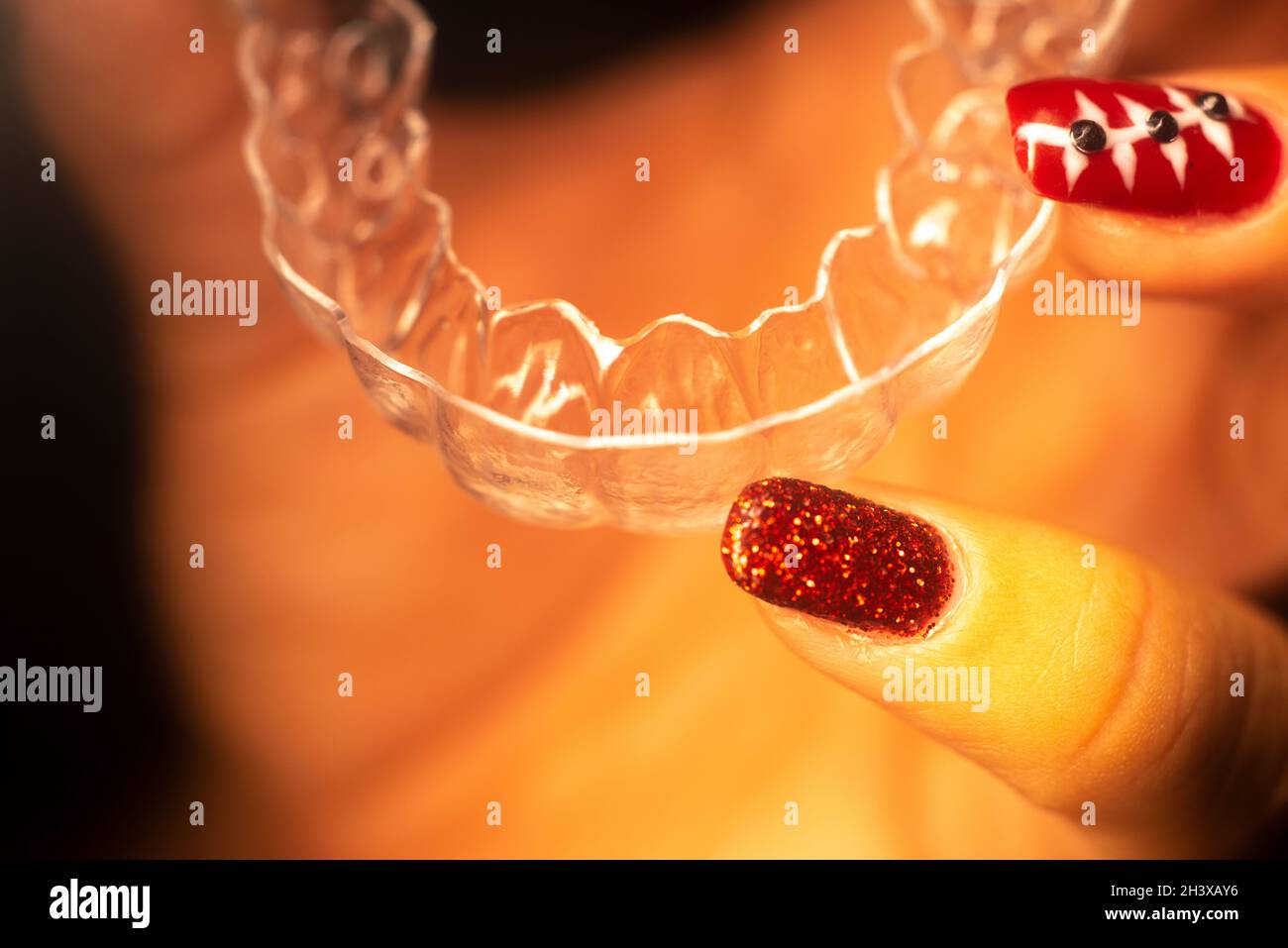 Invisible dental tooth bracket aligners to straighten teeth Stock Photo ...