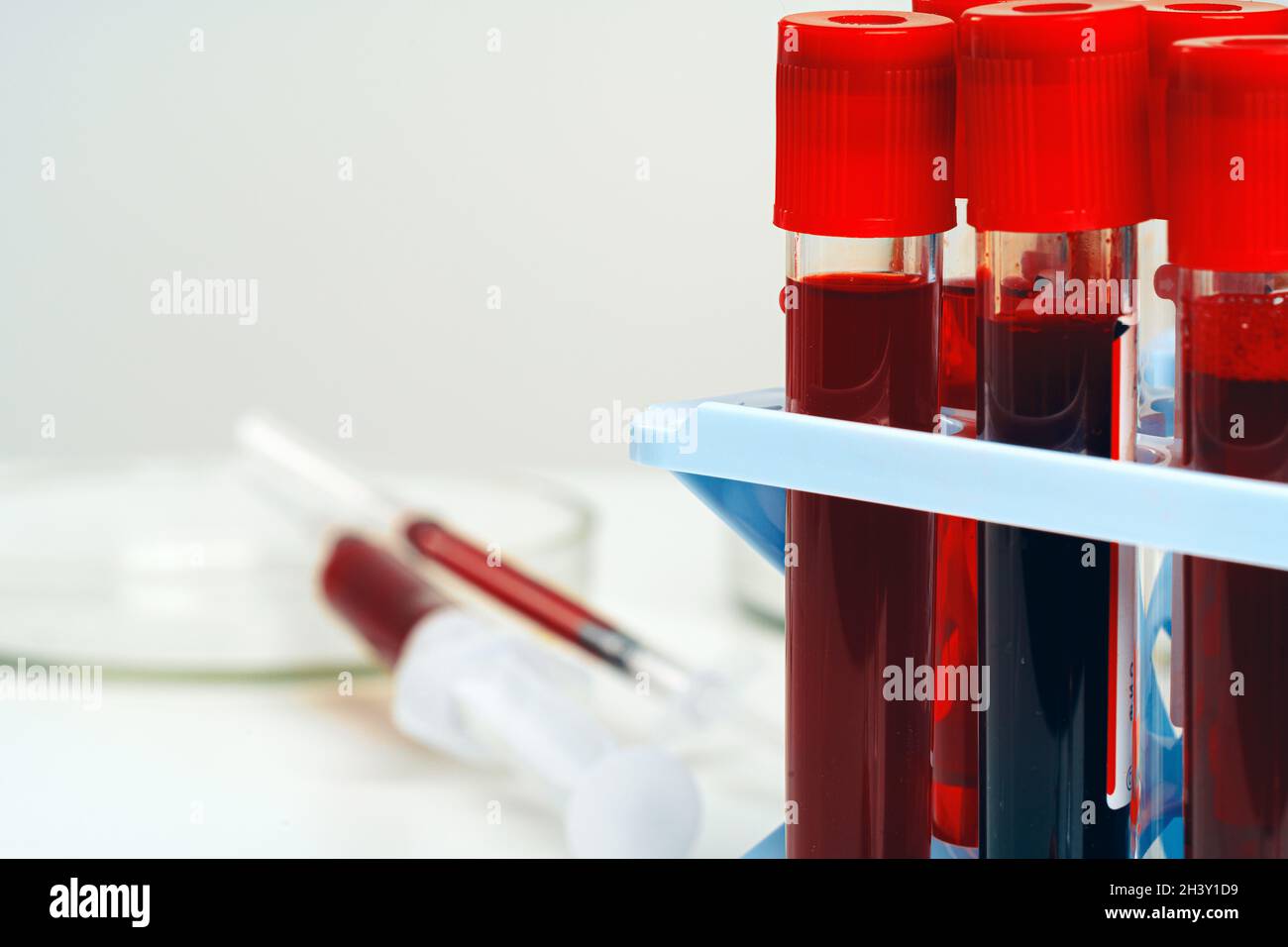 Sample tubes flask container hi-res stock photography and images - Alamy