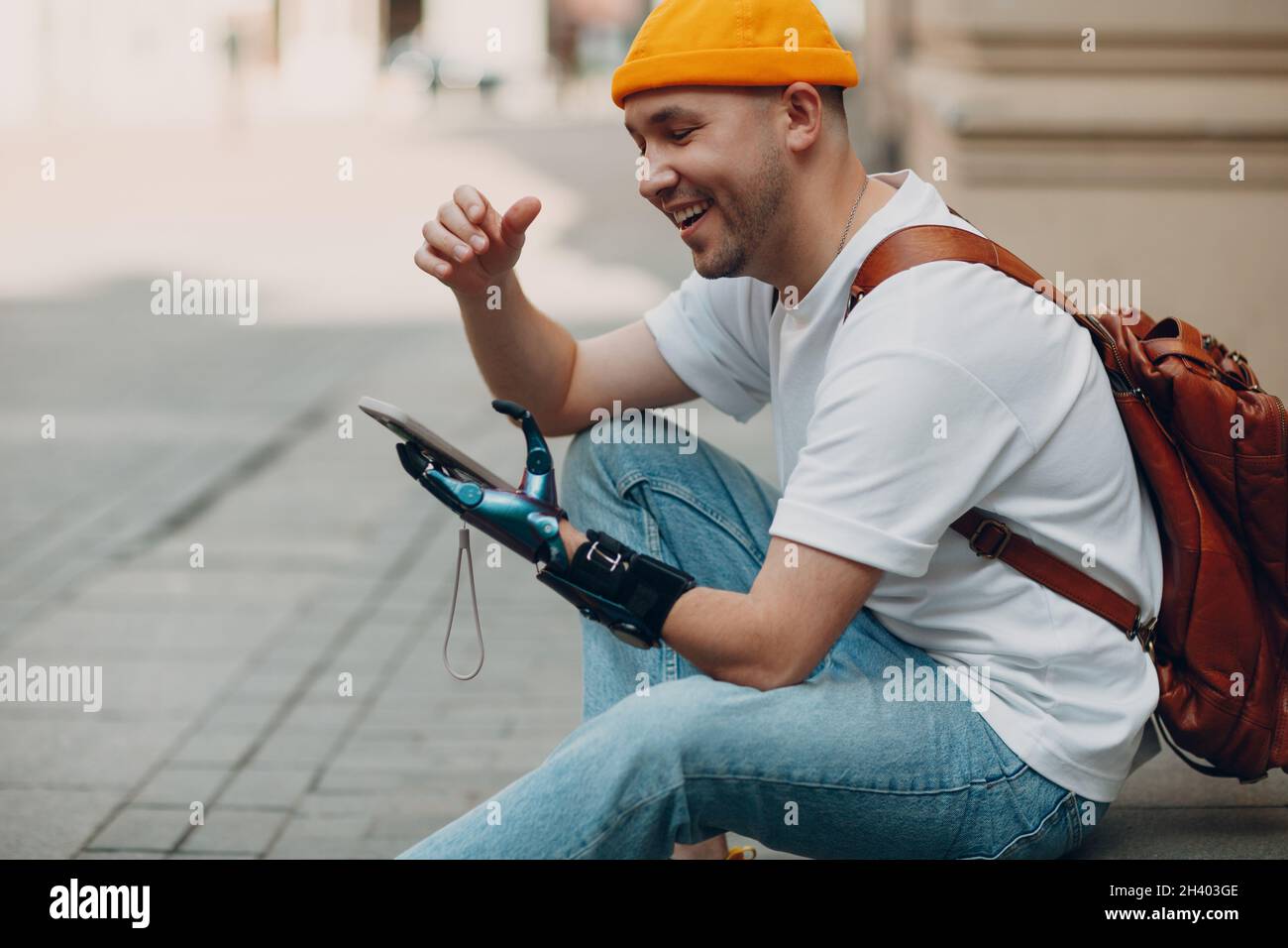 Young disabled man using mobile phone with artificial prosthetic hand ...