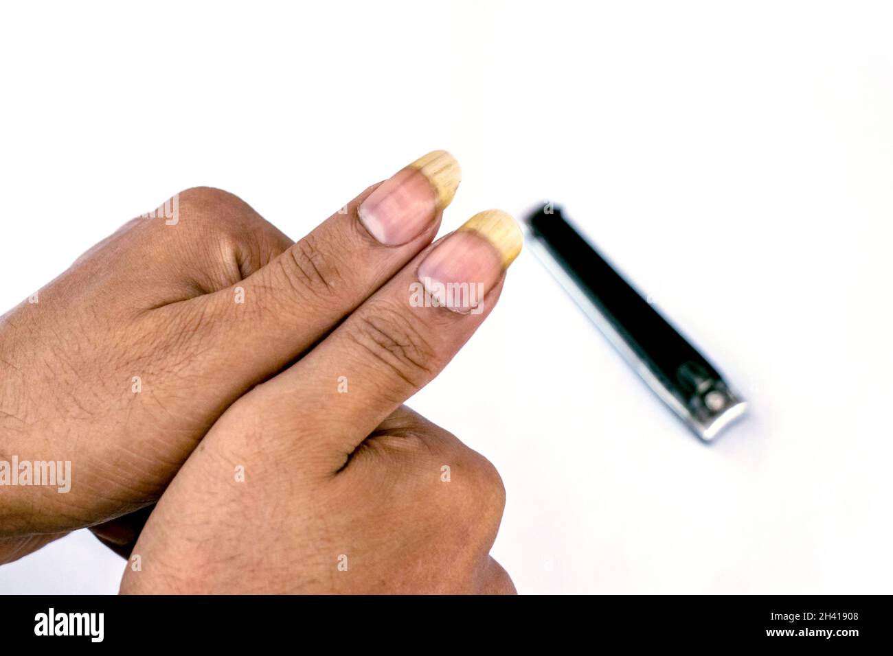 A human showing his big and dirty nails on white background Stock Photo ...