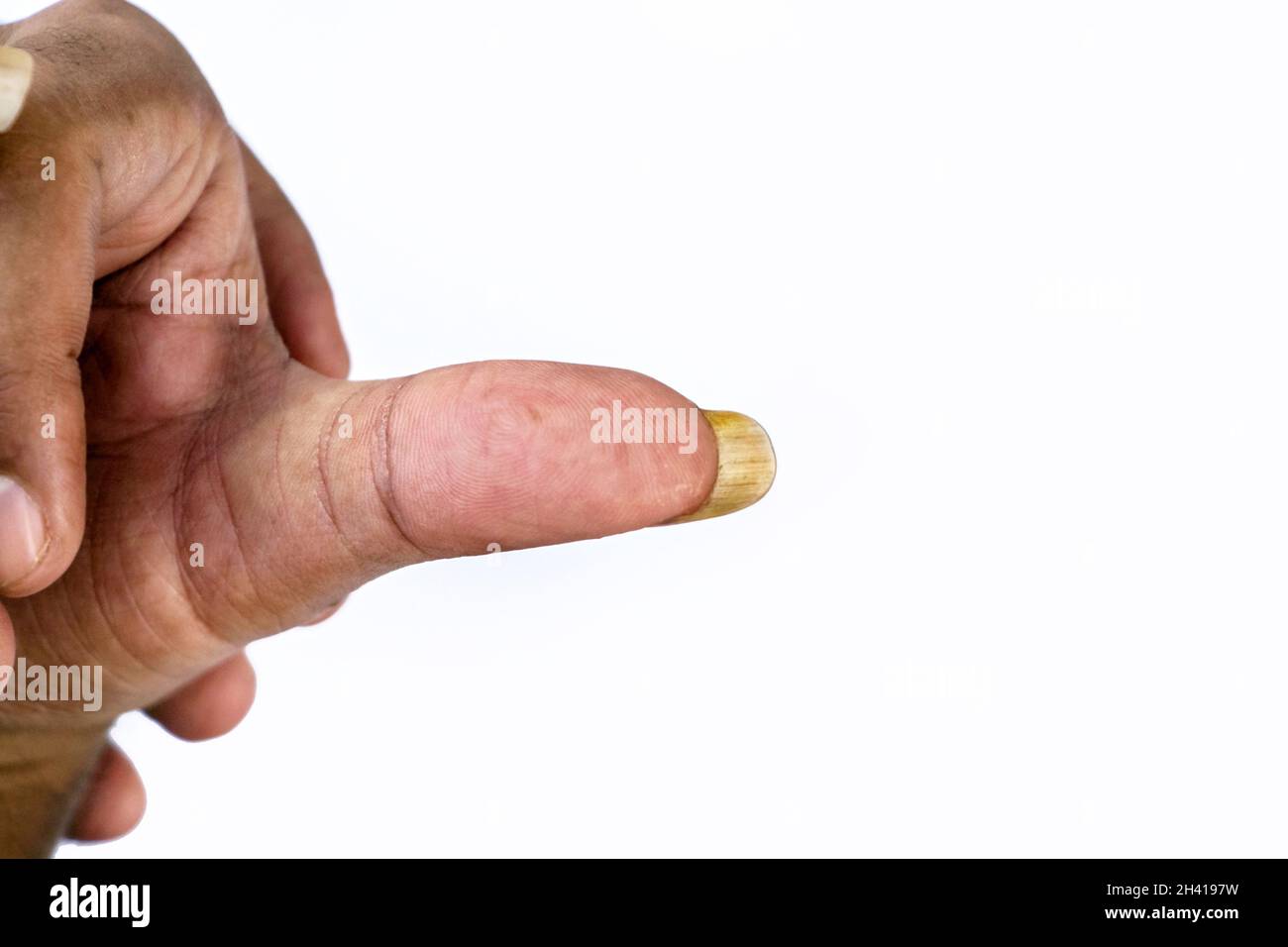 A human showing his big and dirty nails on white background Stock Photo ...