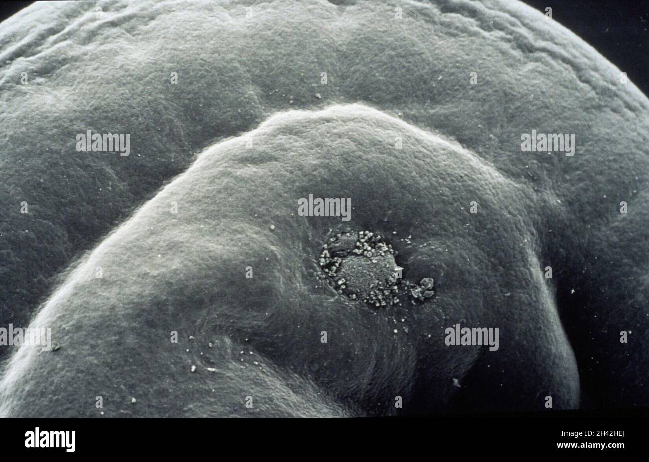 embryo wound healing SEM Stock Photo - Alamy