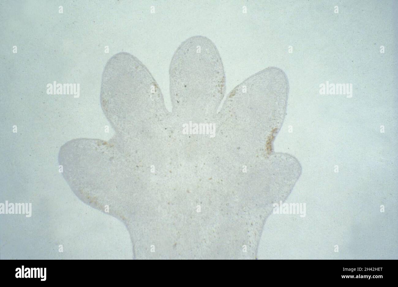 Stages limb development hi-res stock photography and images - Alamy