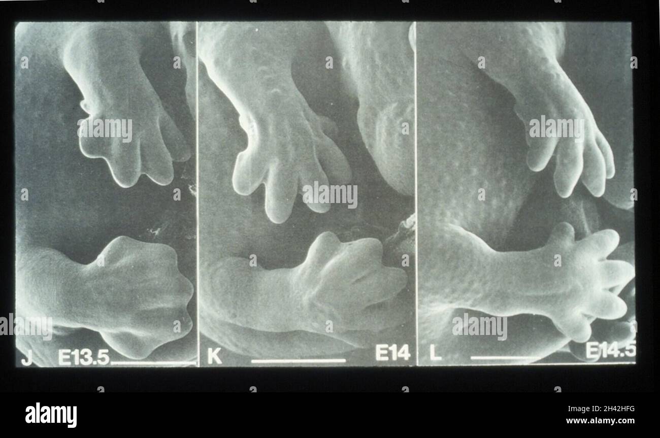 Stages of limb development Stock Photo - Alamy