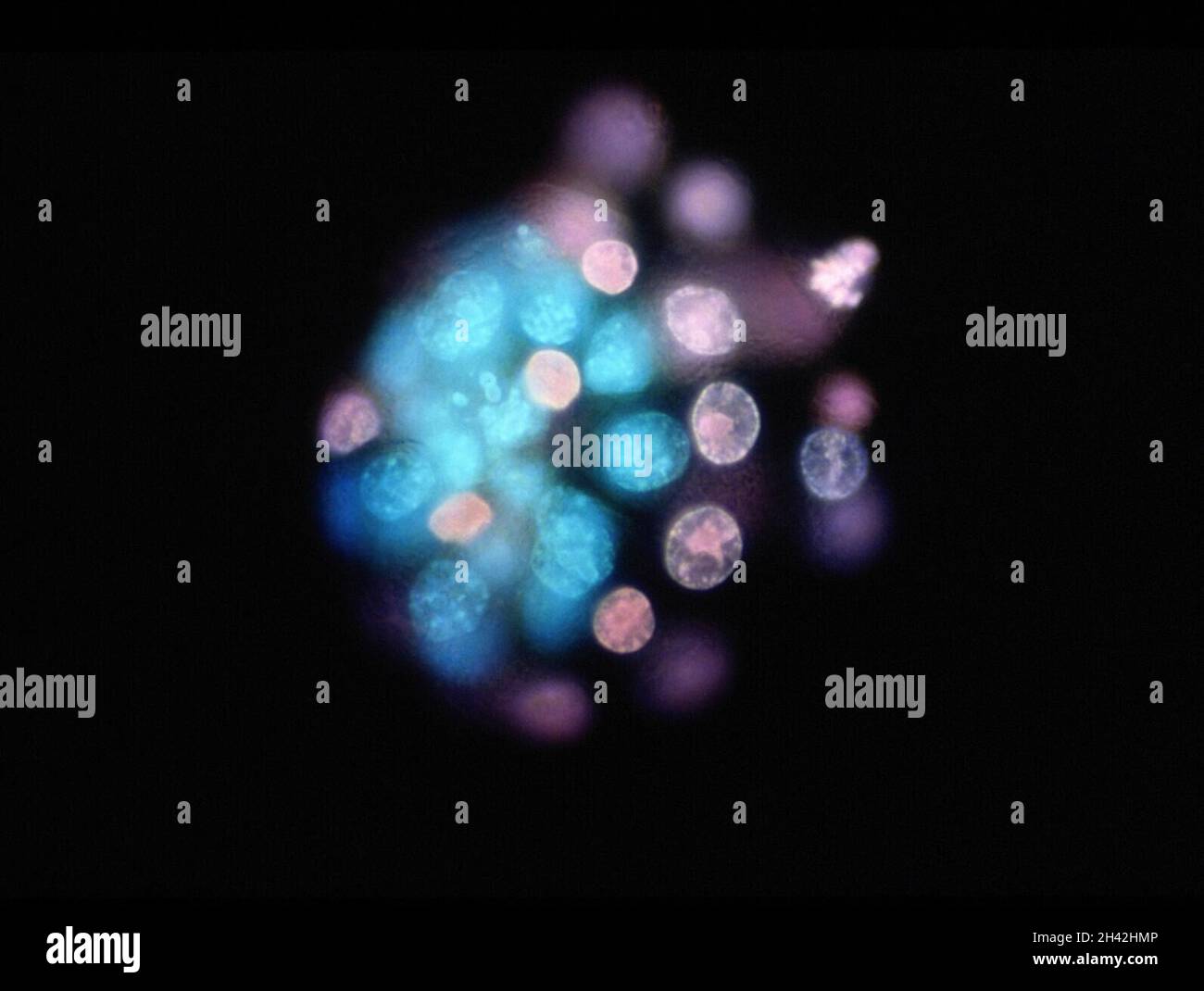 Mouse Blastocyst showing inner cell mass Stock Photo - Alamy