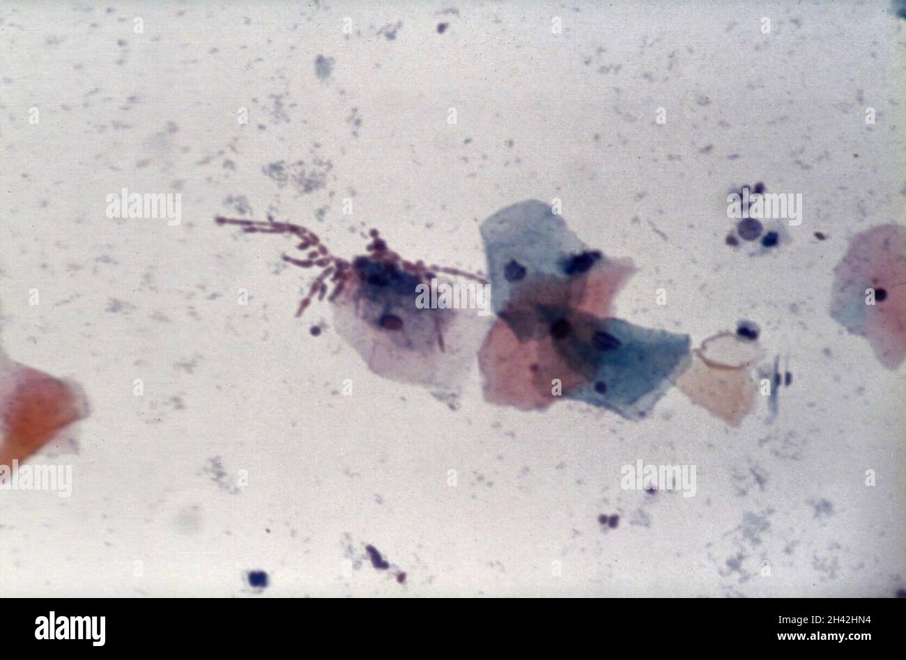 Krusei hi-res stock photography and images - Alamy