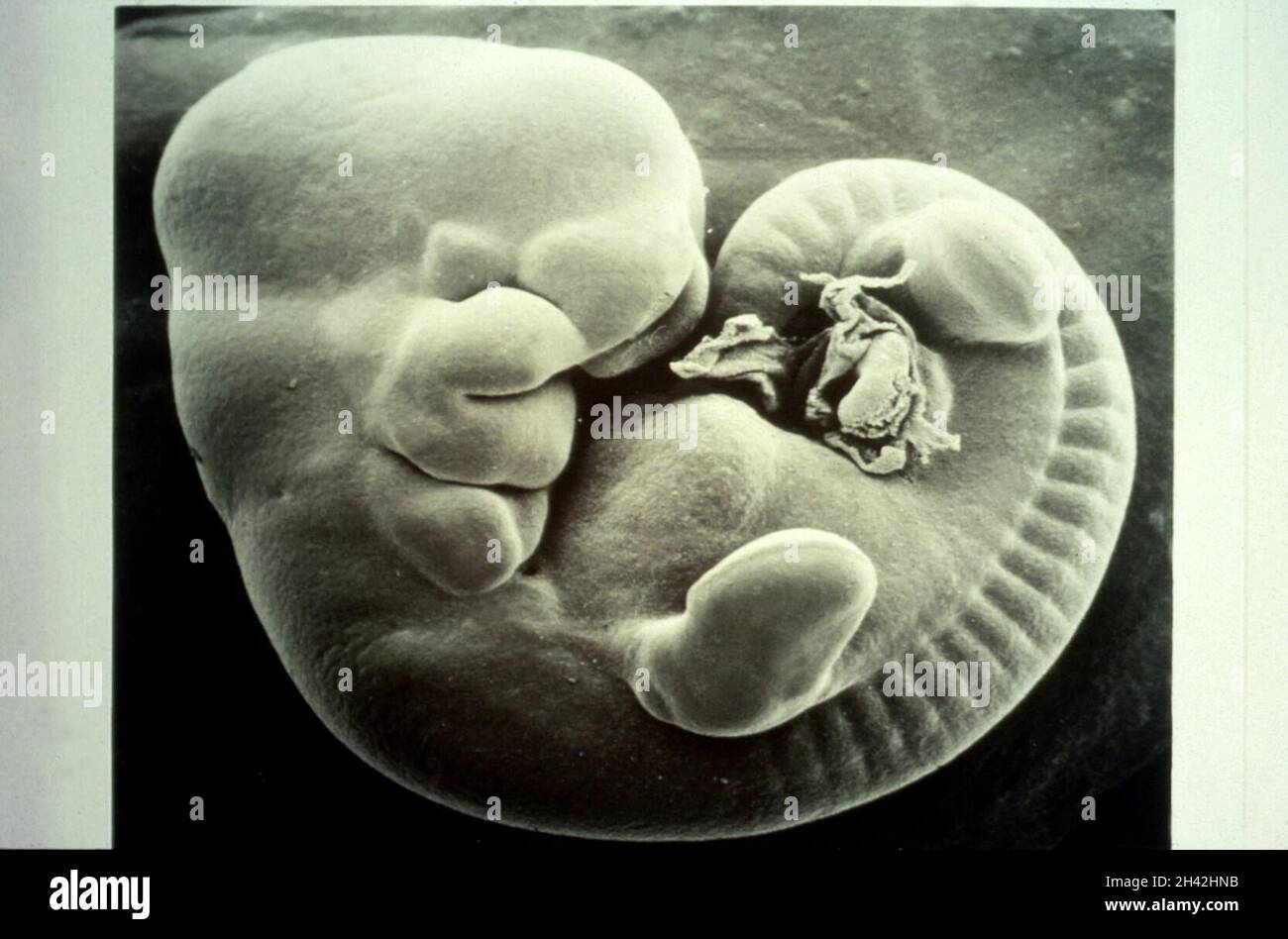 Animal foetus sem hi-res stock photography and images - Alamy