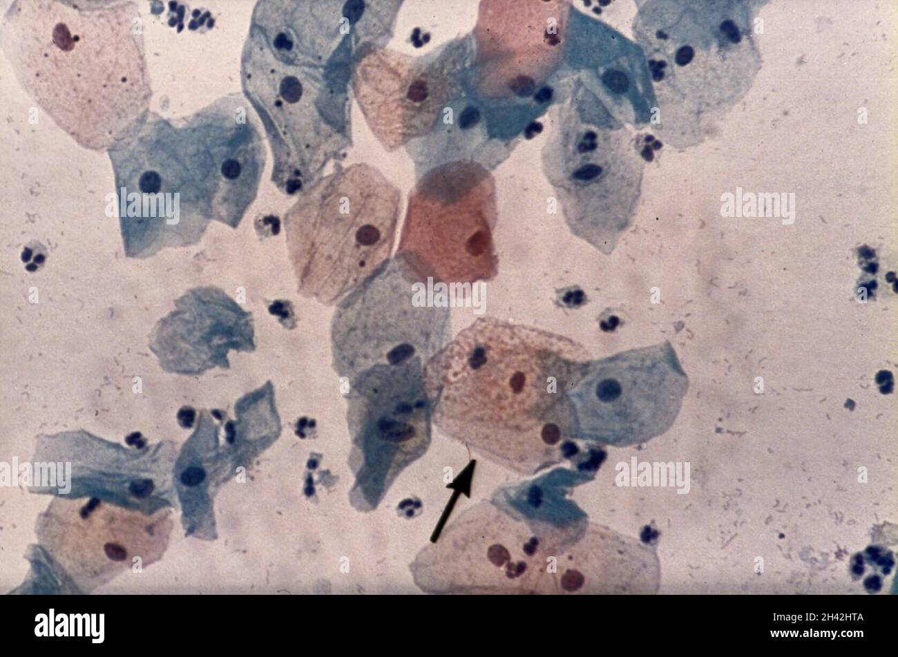 Intermediate cells hi-res stock photography and images - Alamy