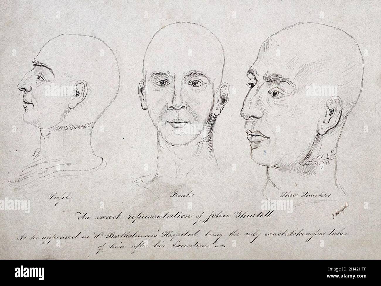 The head of John Thurtell after his hanging. Pen drawing by J. Wentzell ...