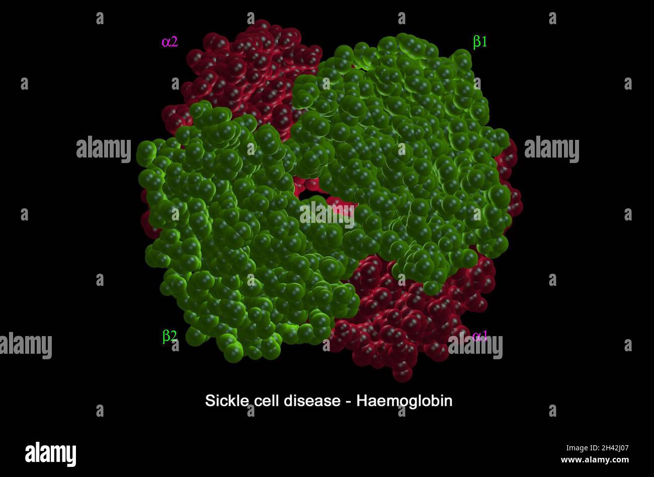 Sickle cell disease - mol. model haemoglobin Stock Photo - Alamy