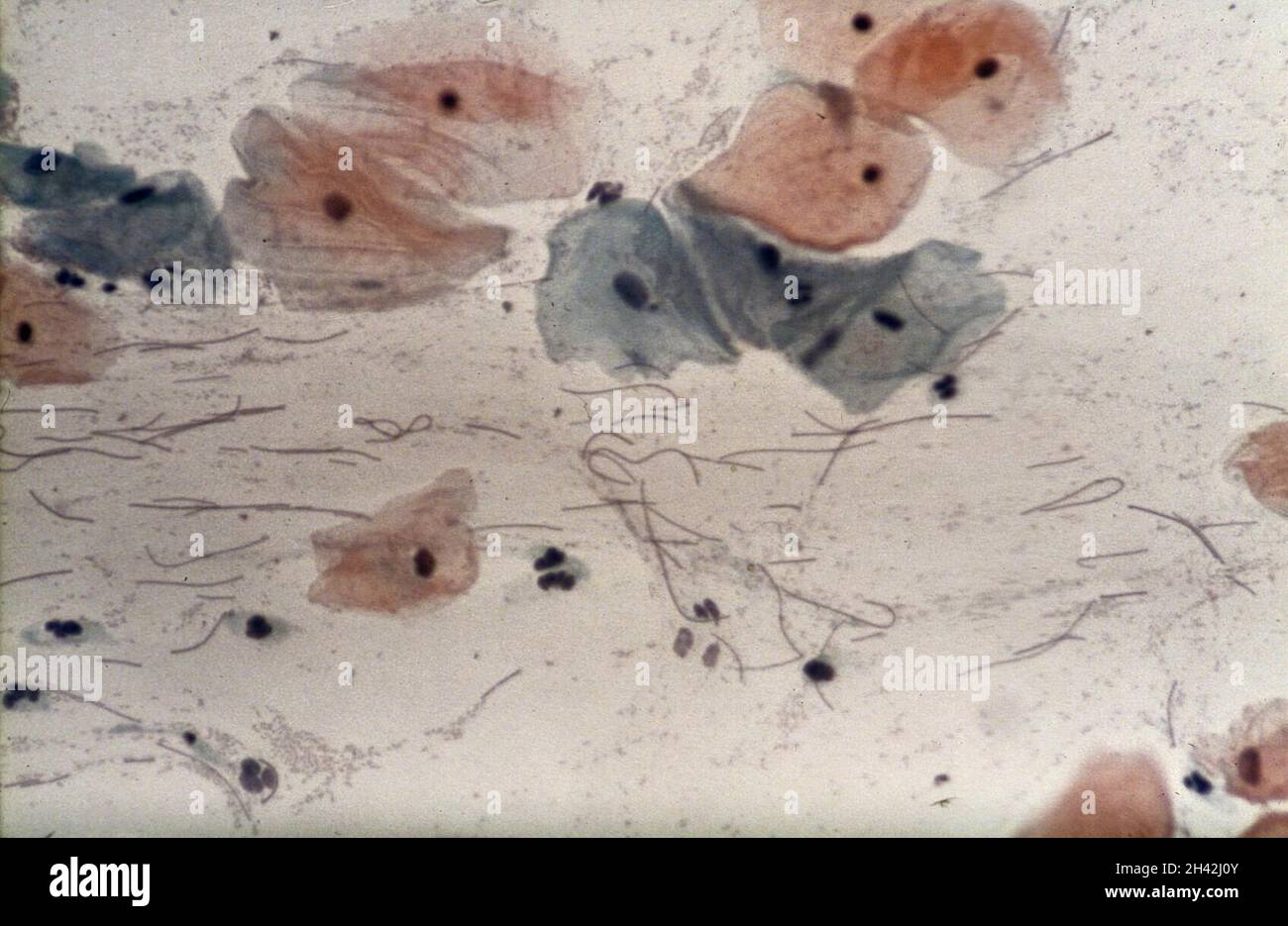 Leptothrix hi-res stock photography and images - Alamy