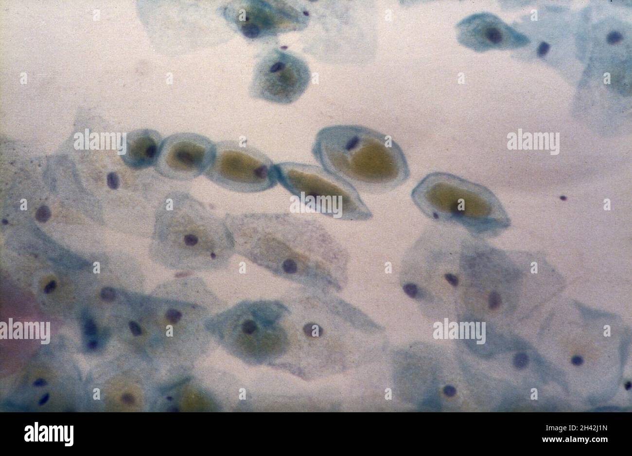Navicular cells, oyster cells Stock Photo - Alamy