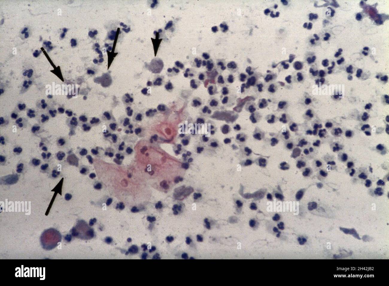 Trichomonas vaginalis hi-res stock photography and images - Alamy