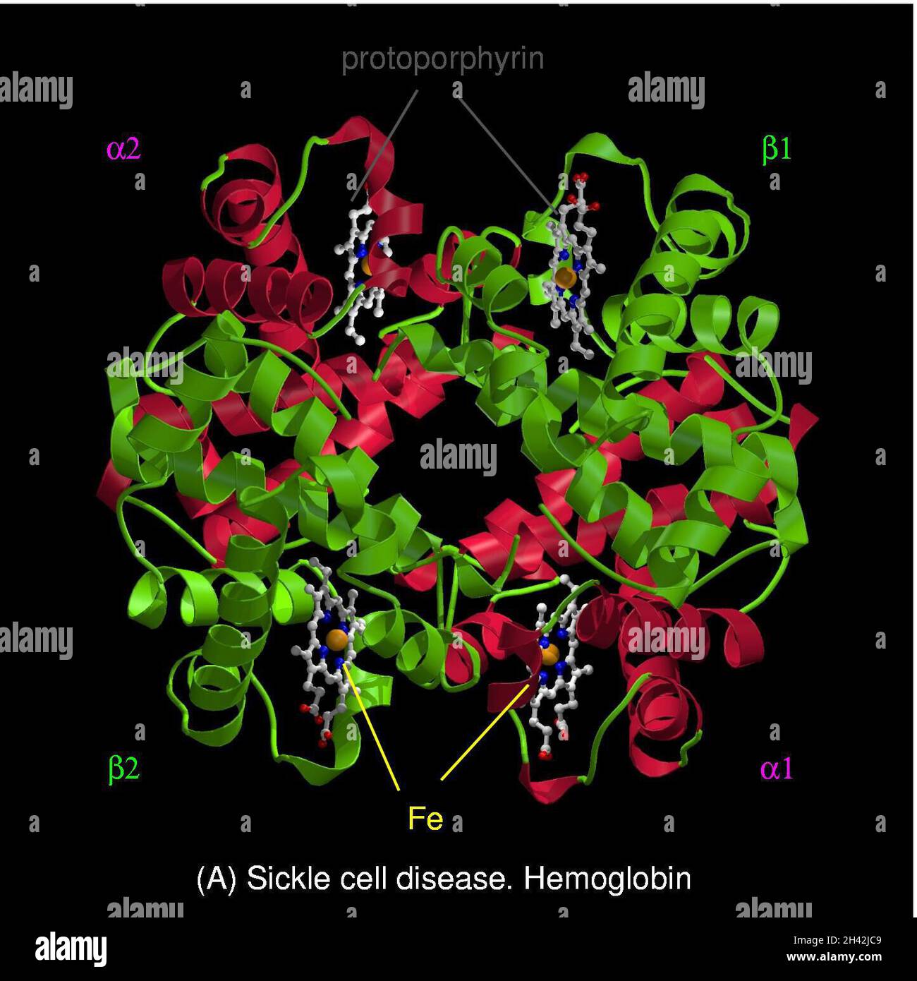 Sickle cell disease - mol. model haemoglobin Stock Photo - Alamy