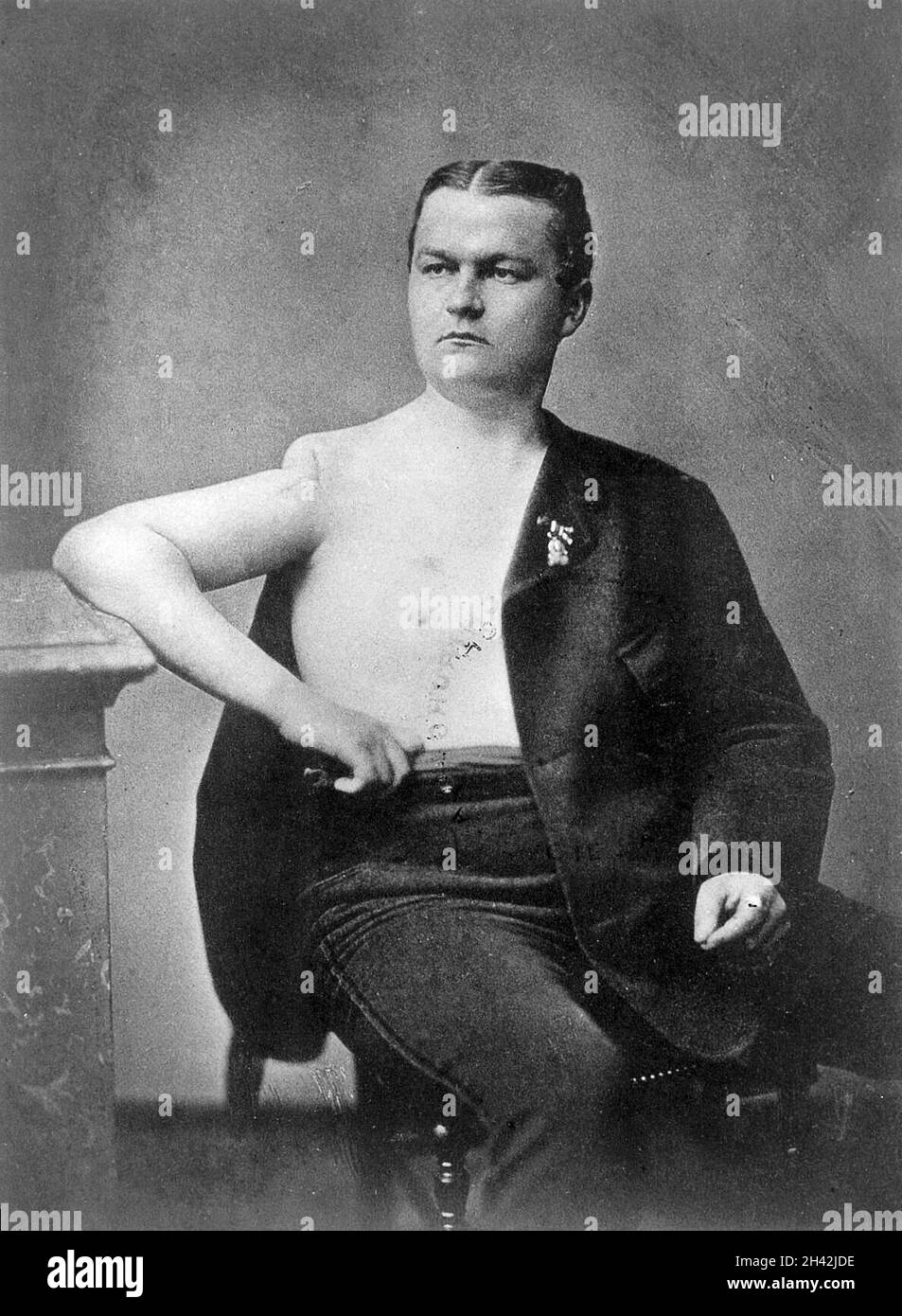 Resected hi-res stock photography and images - Alamy