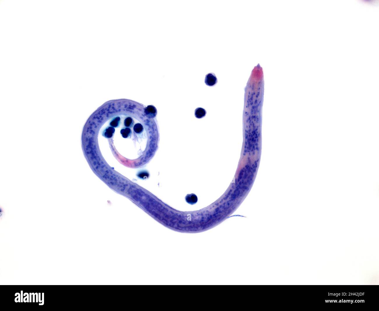 Filariform larva - Strongyloides stercoralis Stock Photo - Alamy