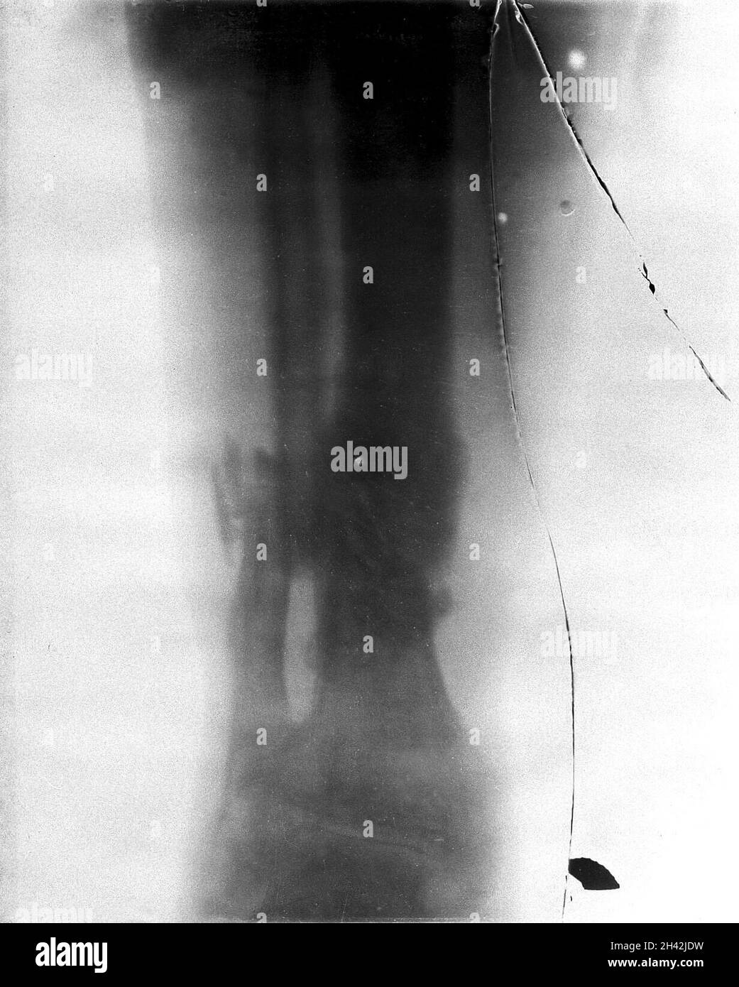 Radiology africa Black and White Stock Photos & Images - Alamy