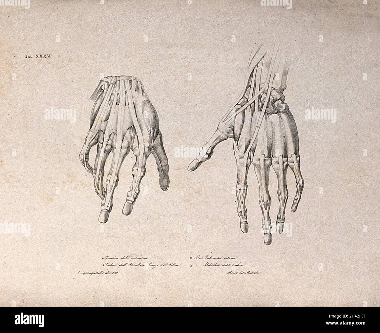 Muscles and ligaments of the hand: two figures of écorché hands ...