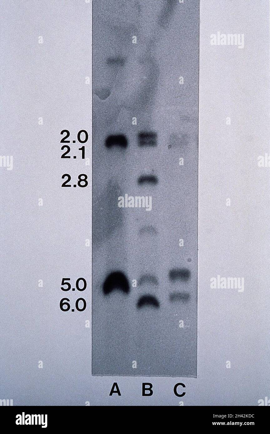 Autoradiograph dna hi-res stock photography and images - Alamy