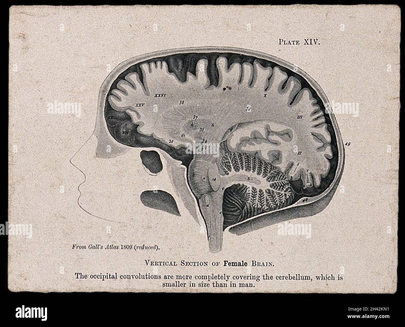 A female brain, sectioned vertically: side view. Process print, 1901 ...