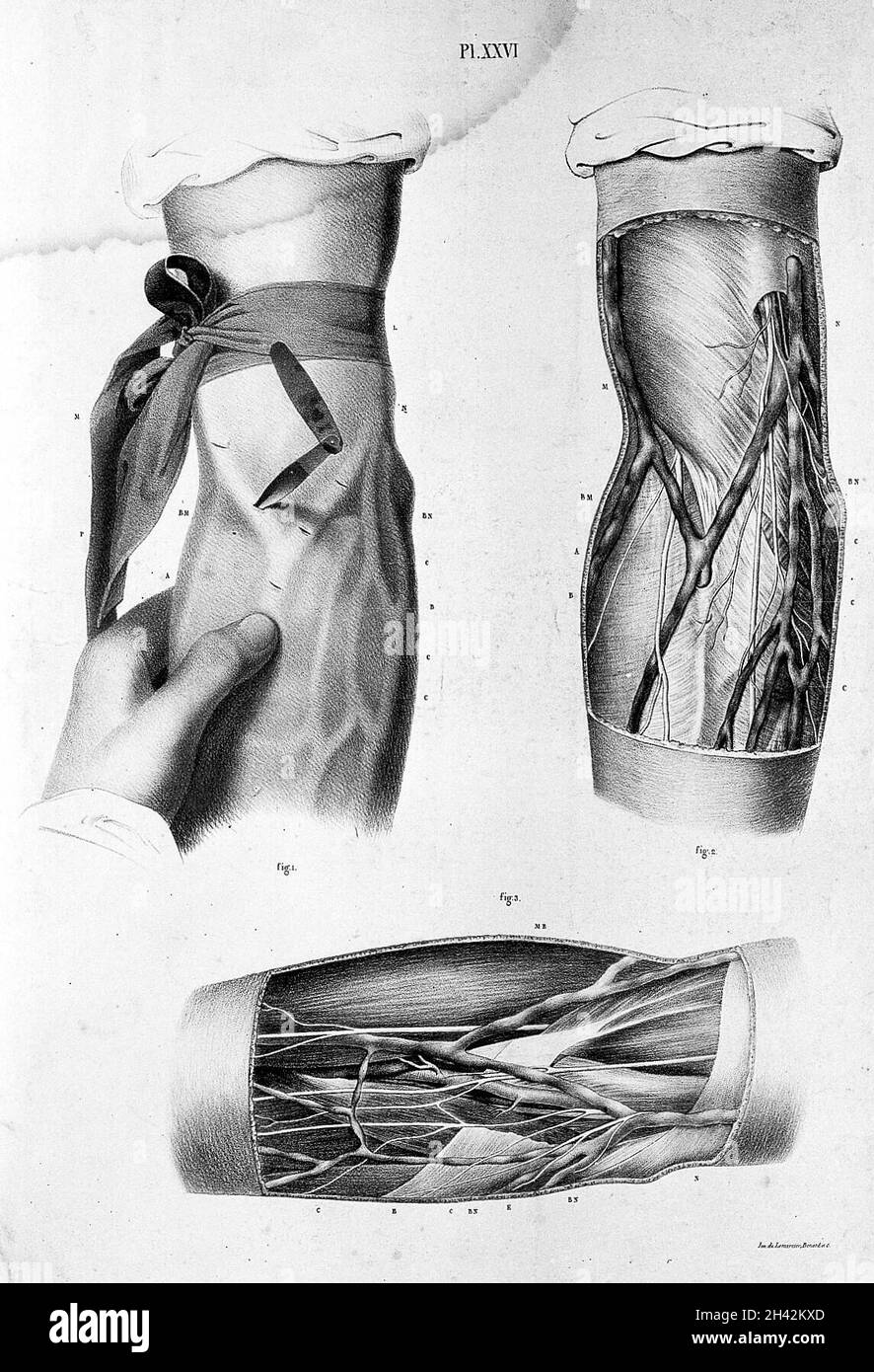 Traditional birth practice hi-res stock photography and images - Alamy