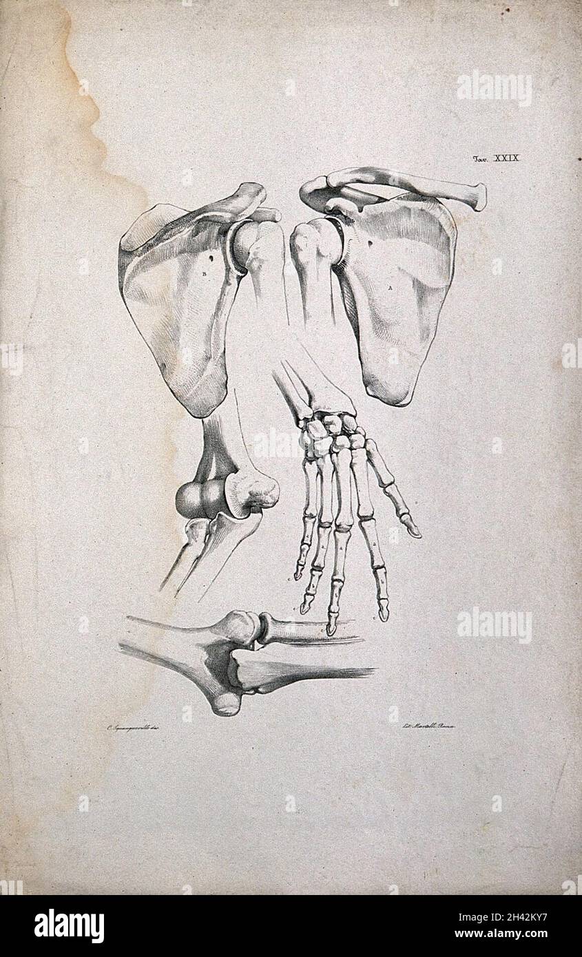 Bones of the shoulder, arm and hand: four figures. Lithograph by ...