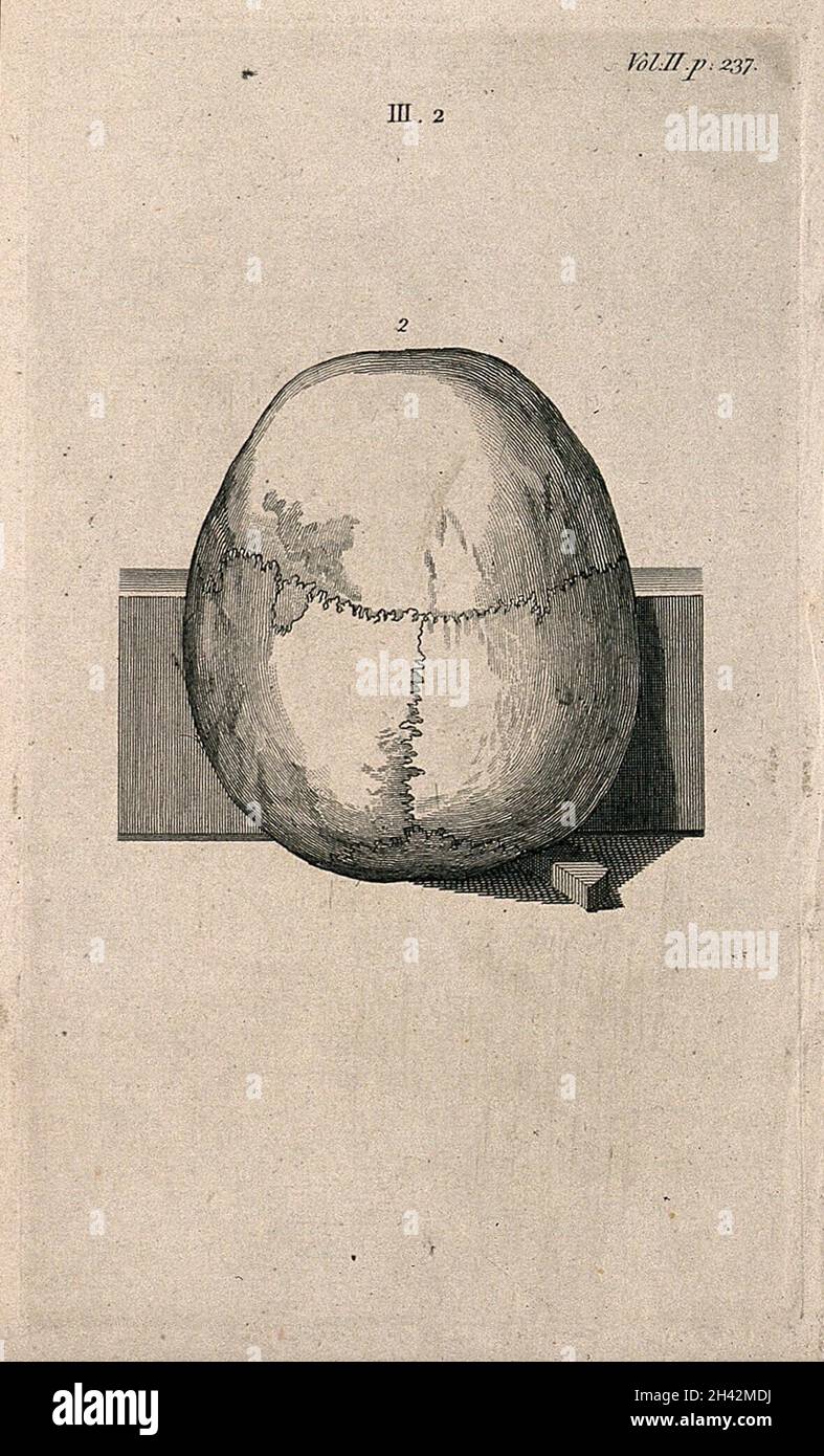 Human skull, seen from above. Line engraving, 1780/1800 Stock Photo - Alamy