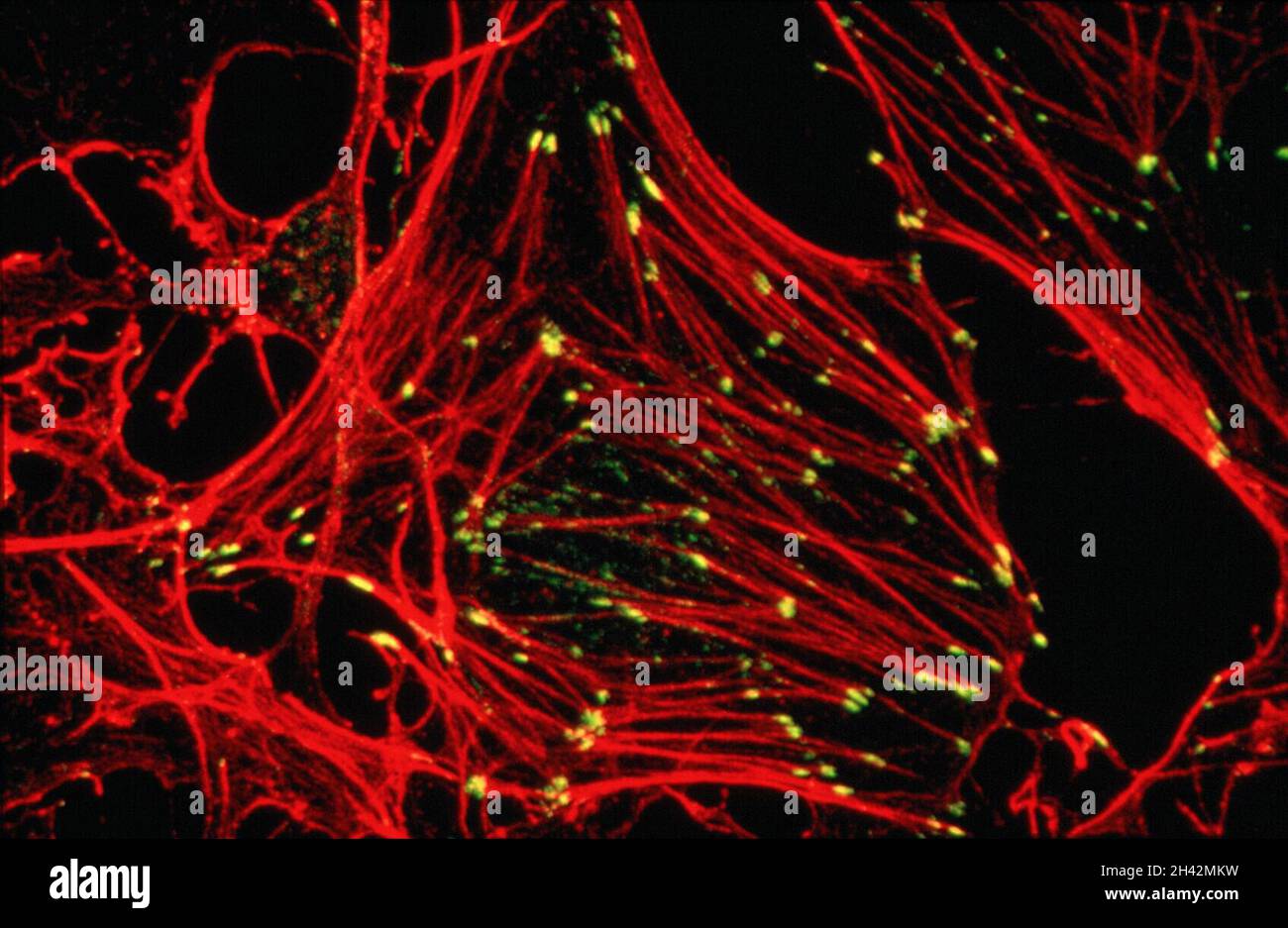 Stress fibres hi-res stock photography and images - Alamy