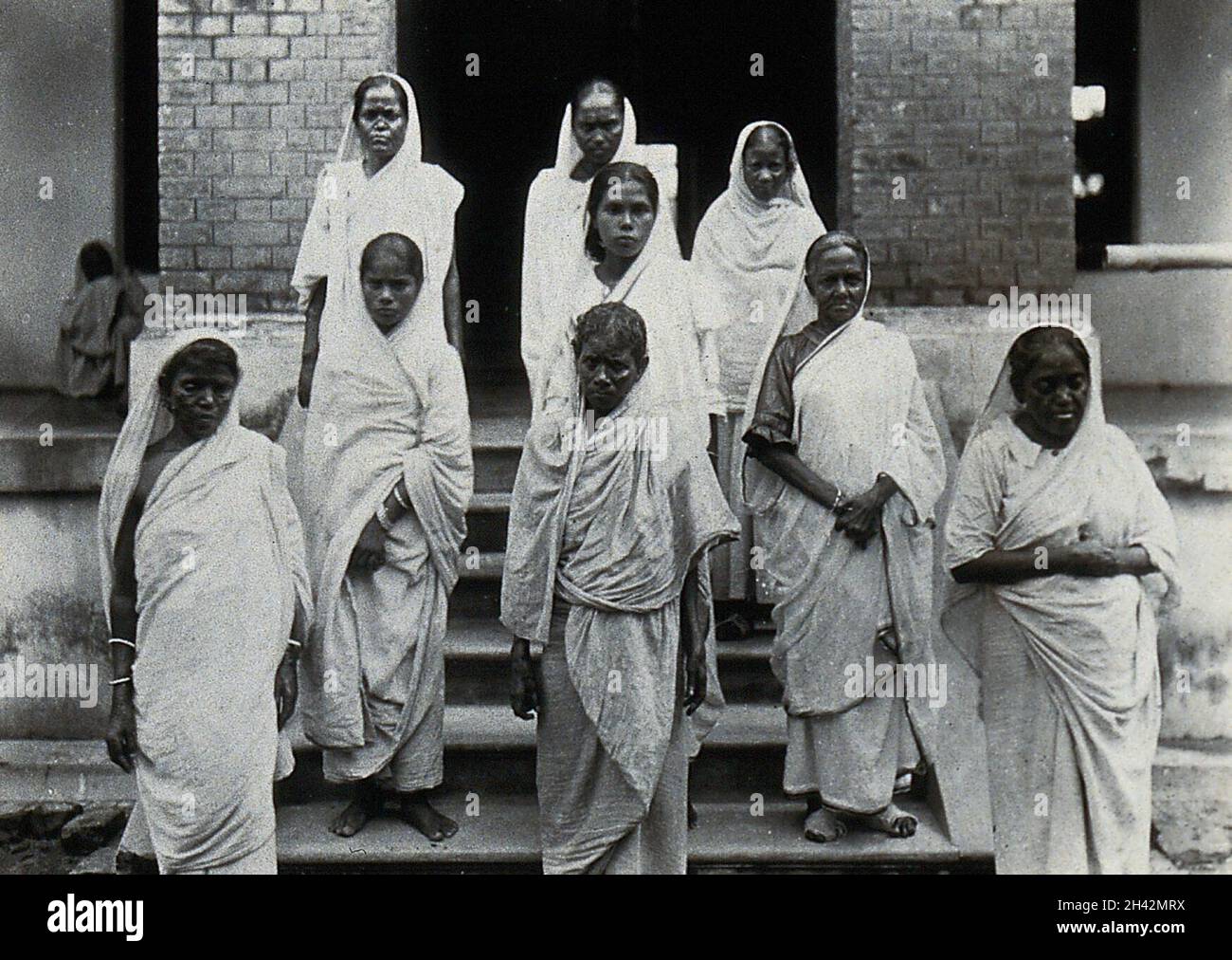 The Albert Victor asylum for lepers, Gohea, Calcutta, India: female ...