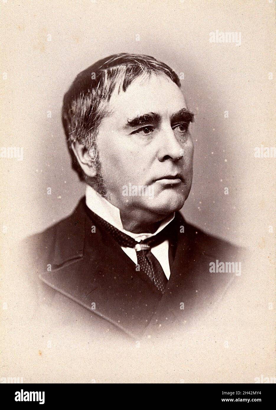 Sir William Withey Gull. Photograph by G. Jerrard, 1881 Stock Photo - Alamy
