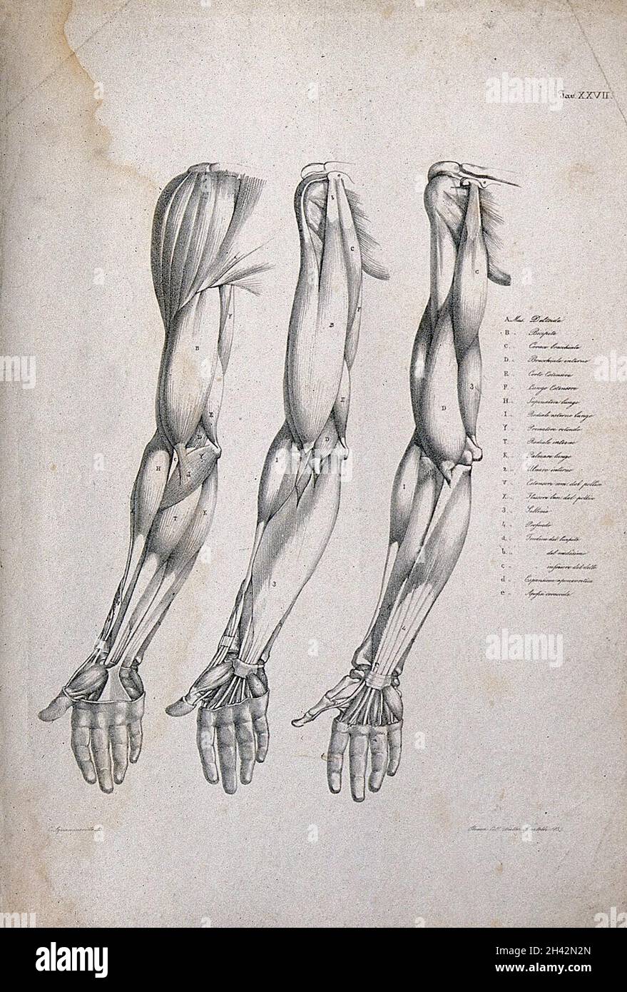 Muscles of the arm and hand: three figures of écorché arms. Lithograph ...