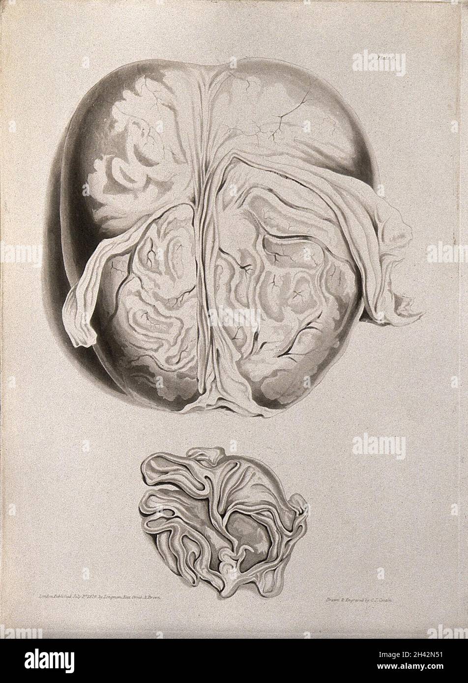 A dissected brain; and a section of a child's brain. Aquatint by C. J ...