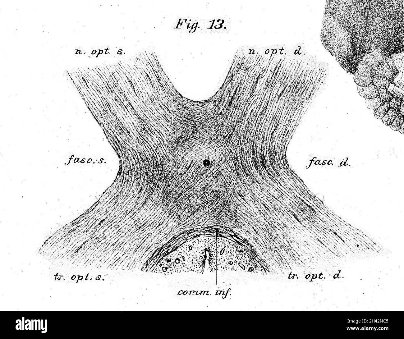 Optic chiasm hi-res stock photography and images - Alamy