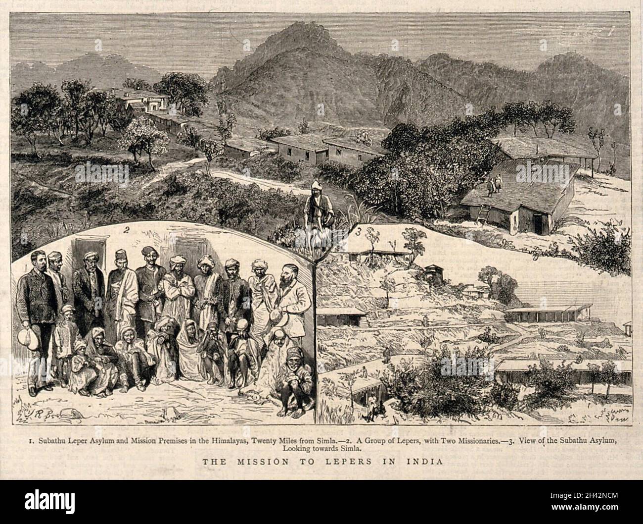 Three vignettes: a group of people with leprosy, two missionaries and a ...