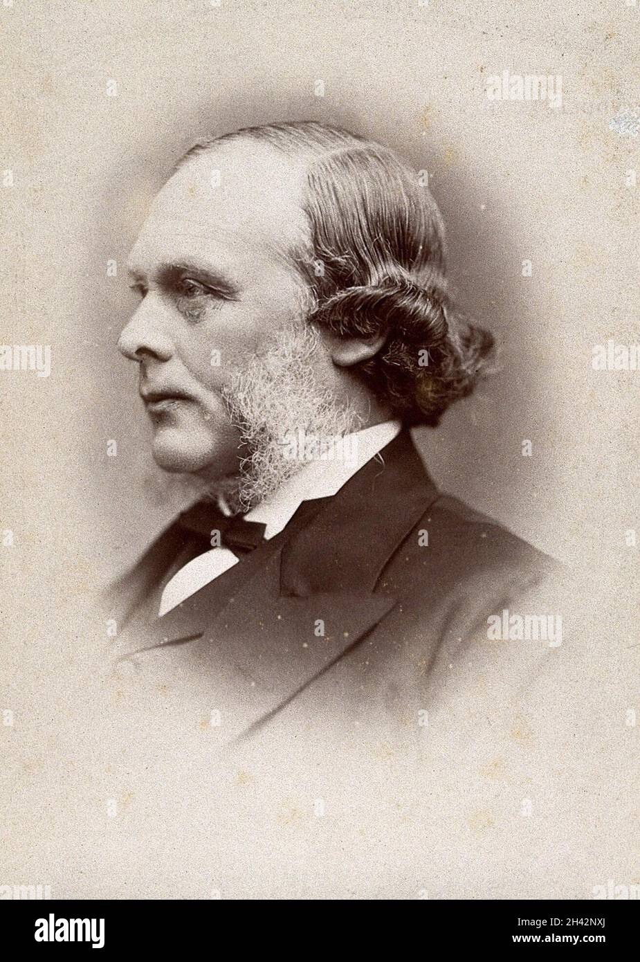 Joseph Lister, Baron Lister. Photograph by G. Jerrard, 1881 Stock Photo ...