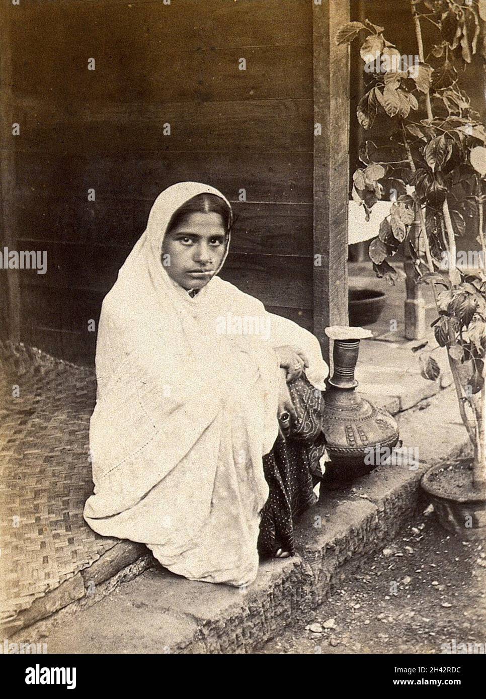 Female patient recovering from bubonic plague, during the ou Stock ...
