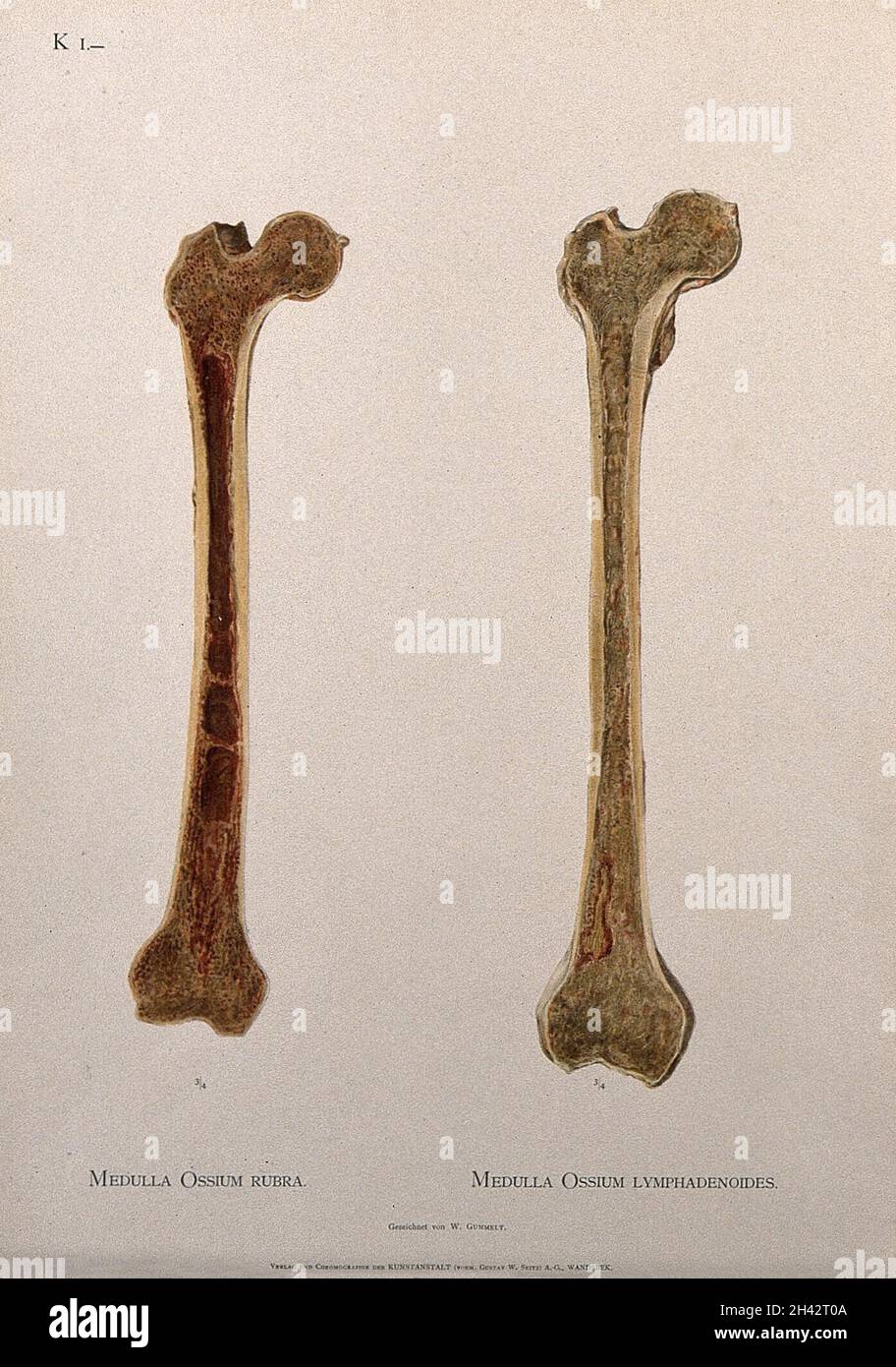 Sections through two femur bones: the left illustration indicating the ...
