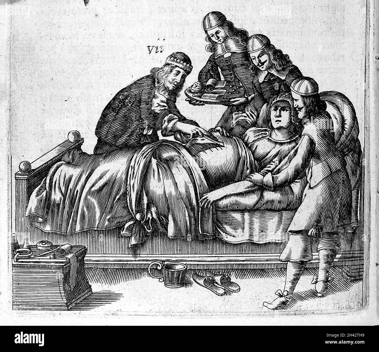 Scultetus "Auctarium....": caesarian section Stock Photo - Alamy