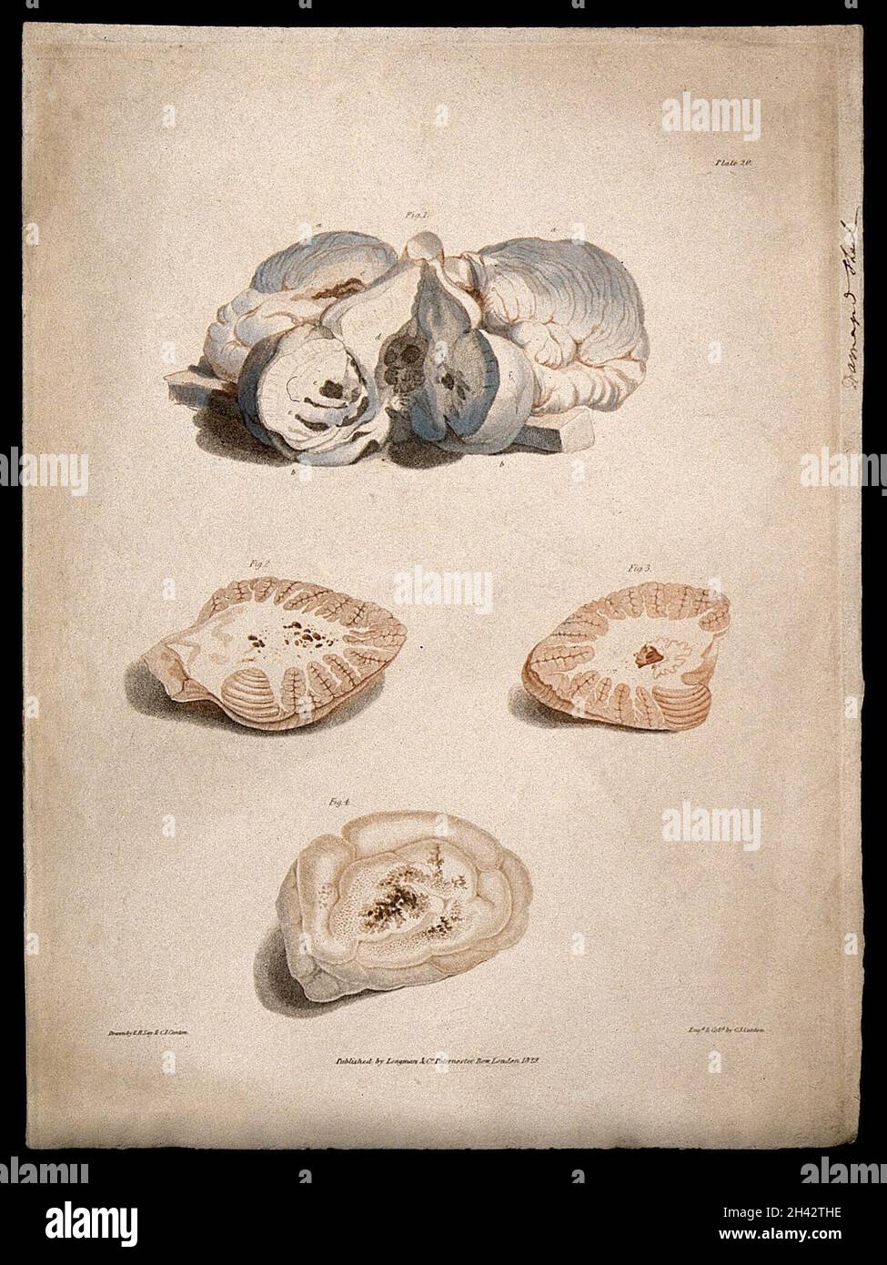 Four sections of diseased brain. Colour stipple etching by C. J. Canton ...