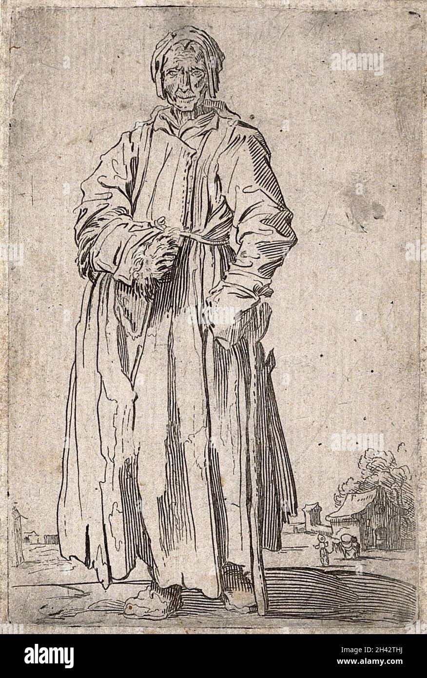 An old woman dressed in rags holding her right arm in a bandage made of ...