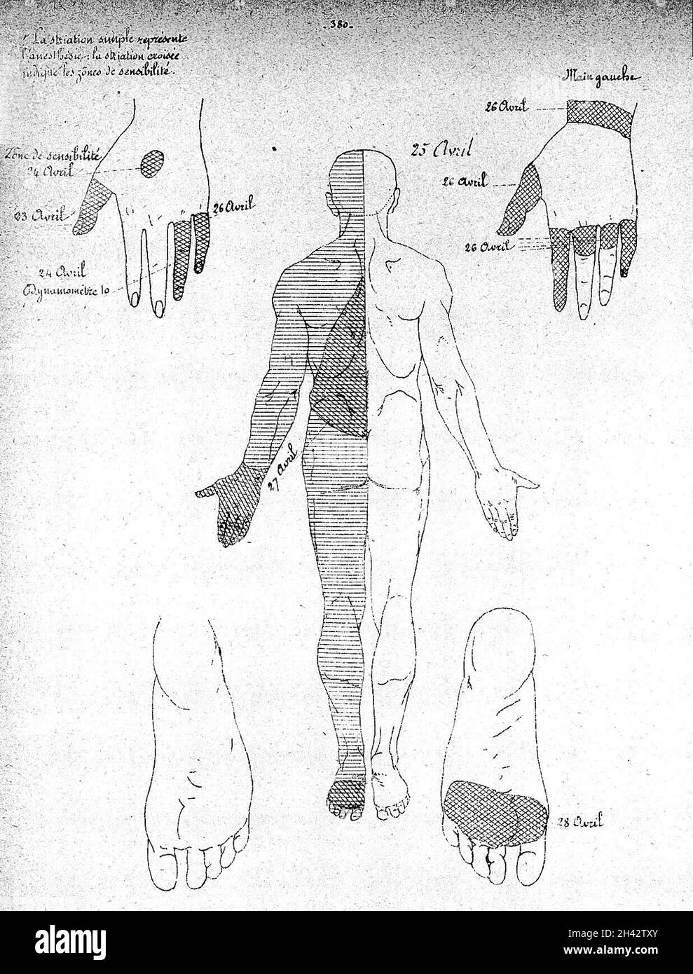 Charcot paris hi-res stock photography and images - Alamy
