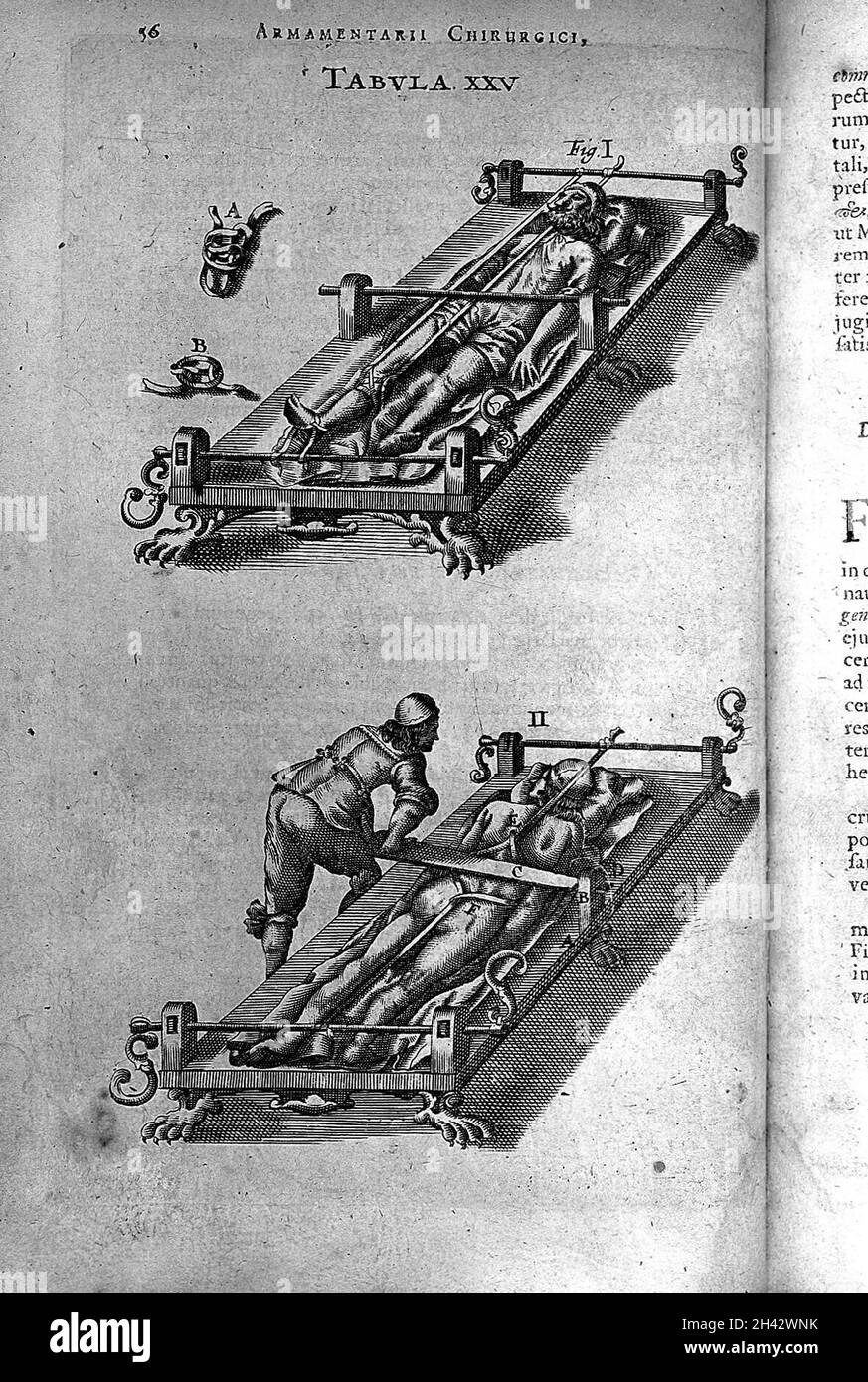 Johannes Scultetus, Armamentarium chirurgicum Stock Photo - Alamy